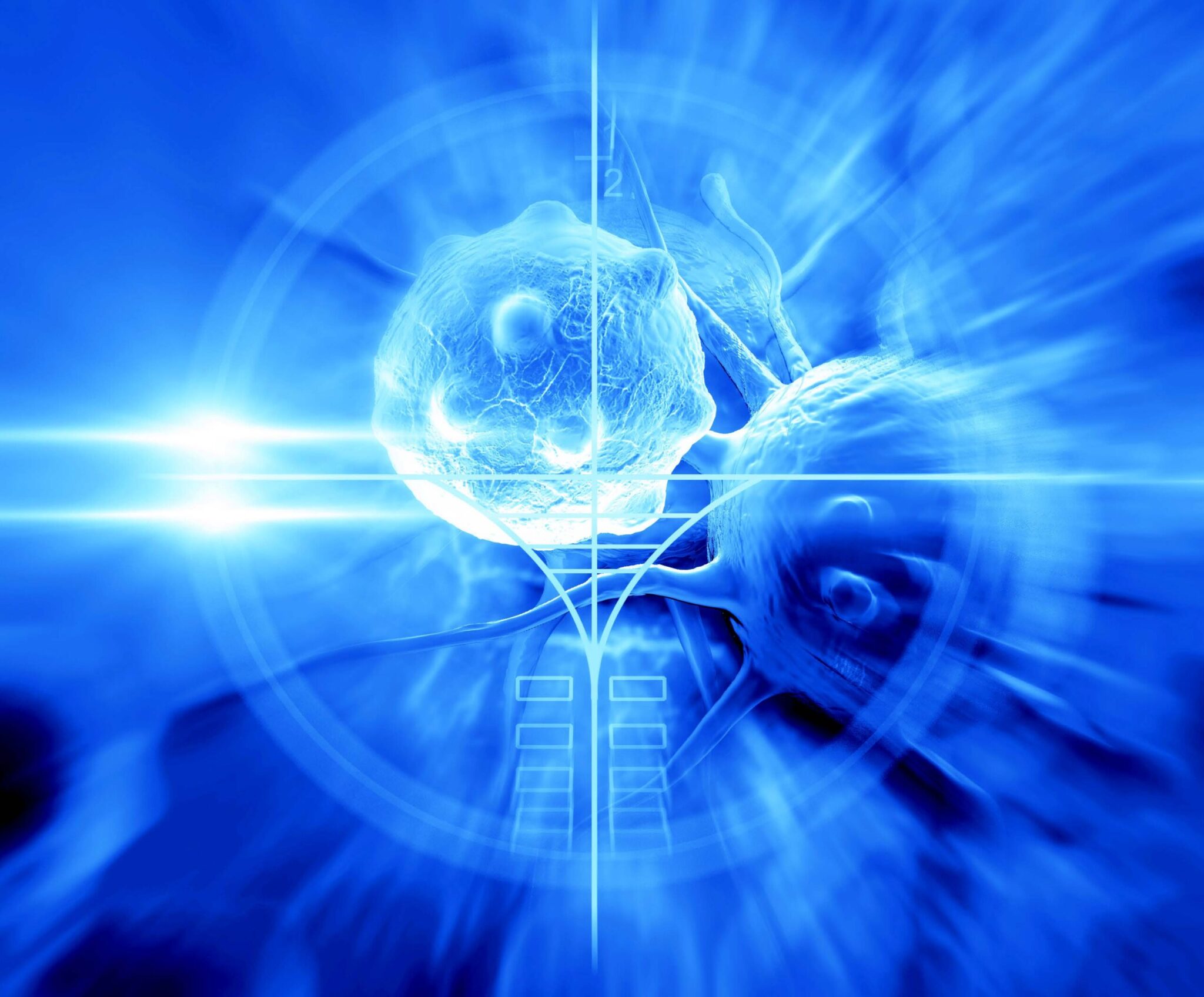 Immunotherapy and Imaging of Metastatic Pancreatic Adenocarcinoma ...